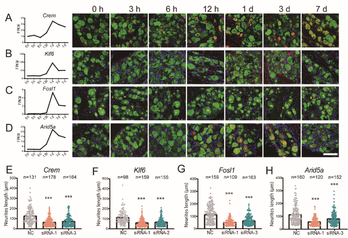 NRR：顾晓松院士团队揭示背根神经节神经元神经损伤后3个反应阶段|院士|顾晓松_新浪新闻