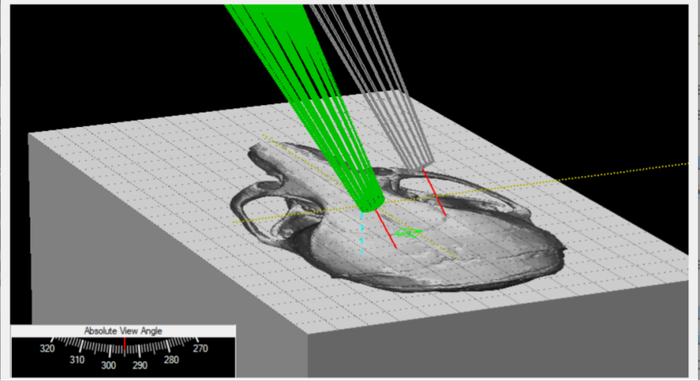 Neuropixels 2.0正式发布：更小体积，更多电极，实现自由活动动物的长期记录|探针|位点|电极|神经元|小鼠_新浪新闻