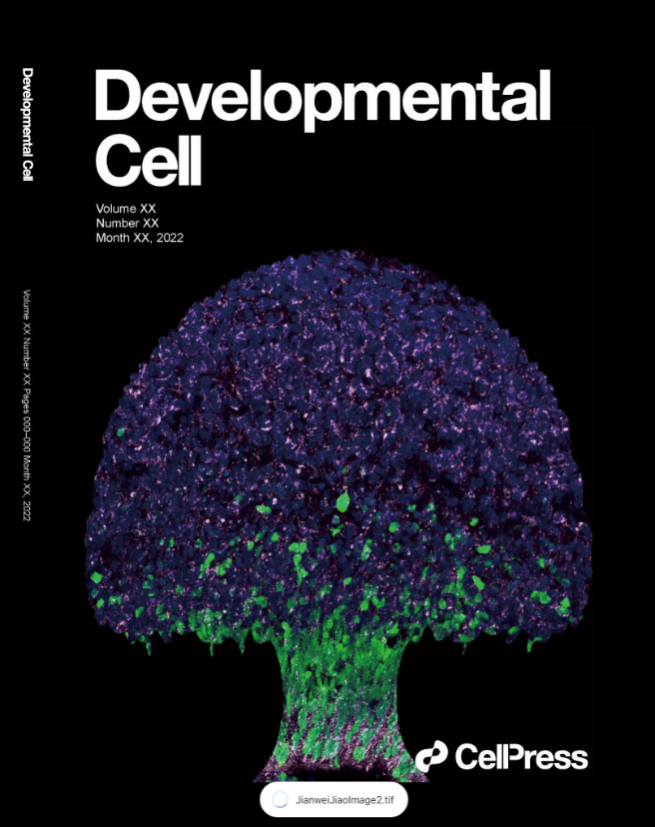 Dev Cell封面：焦建伟课题组揭示溶酶体动力学调控哺乳动物大脑发育__财经头条__新浪财经