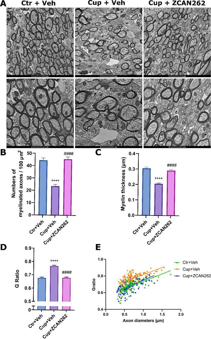 Sci Adv: 刘芳教授基于AI筛选靶向AMPA抑制小分子治疗多发性硬化症__财经头条__新浪财经