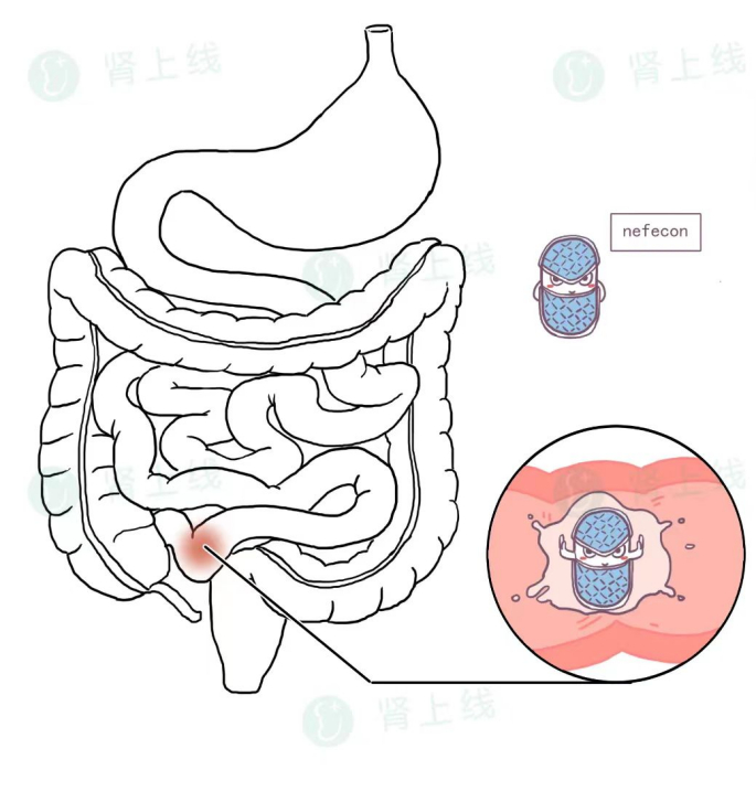 20万一年的IgA肾病靶向药，只是副作用小的激素？耐赋康与传统激素到底有何不同？|肾病_新浪新闻