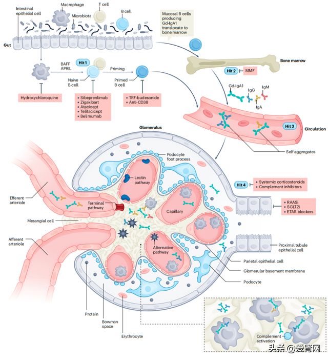 全球首个创新药物耐赋康在中国获批上市用于治疗IgA肾病|肾病|中国_新浪新闻