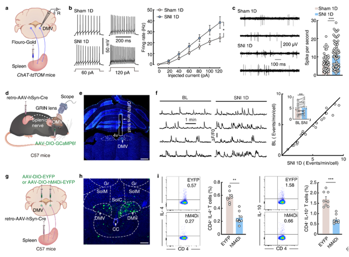 Nat Neurosci：中科大张智团队报道疼痛调控免疫的新神经环路机制，揭示免疫调控解剖特异性