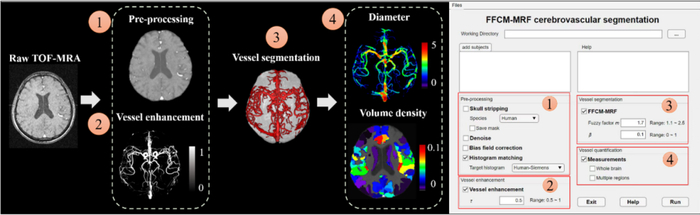 CBM: FFCM-MRF—— 一种准确、可靠的颅内血管自动识别分割方法|猕猴|脑血管|神经|图像|病理性_新浪新闻