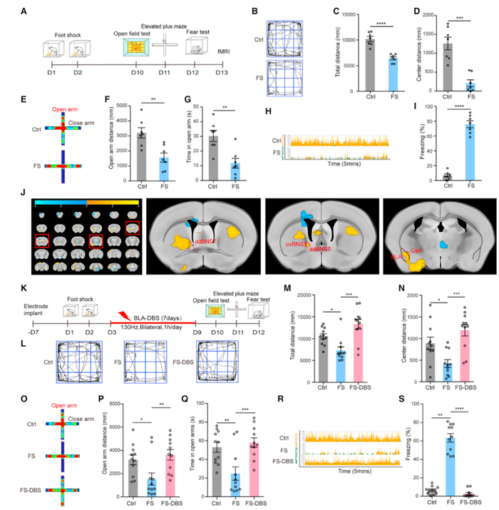 Cell 子刊：王以政院士团队发现深部脑刺激治疗PTSD的关键神经环路机制