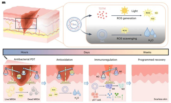 Nat Nanotechnol | 南开大学团队发现糖尿病足溃疡新疗法：Janus脂质酶修复受损组织与促进愈合|南开大学_新浪新闻
