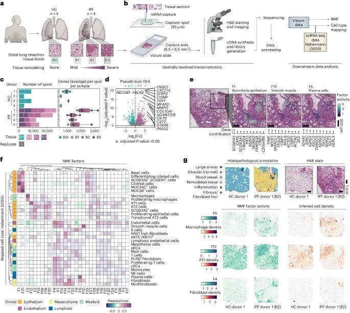 Nature Genetics | 揭示肺纤维化新视界：从小鼠到人的空间转录组学描绘特发性肺纤维化（IPF）病理机制|新视界|细胞|小鼠_新浪新闻