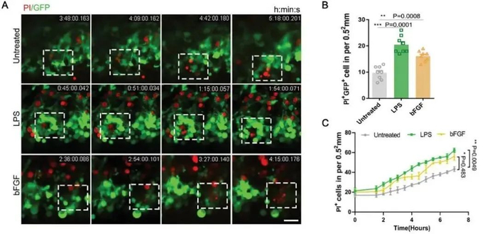 Adv Sci：焦建伟团队揭示GSDMD调节的代谢轴在促进神经发生的新机制