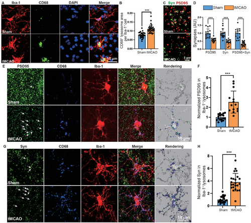 Adv Sci：熊利泽/田莉/胡霁合作发现小胶质细胞Clec7a在缺血性中风中的作用机理