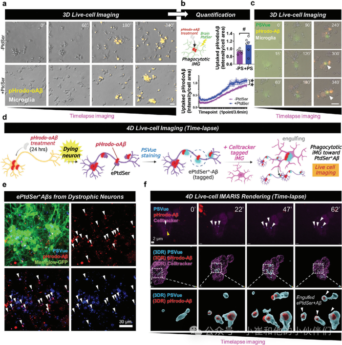 Adv Sci：小胶质细胞通过TREM2被外部磷脂酰丝氨酸包围的Aβ吸引|活细胞_新浪新闻