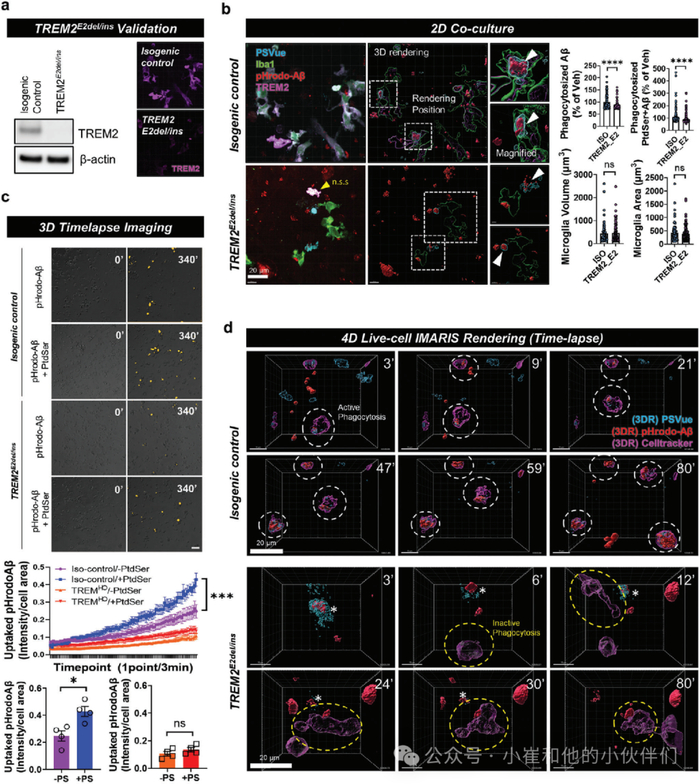 Adv Sci：小胶质细胞通过TREM2被外部磷脂酰丝氨酸包围的Aβ吸引|活细胞_新浪新闻