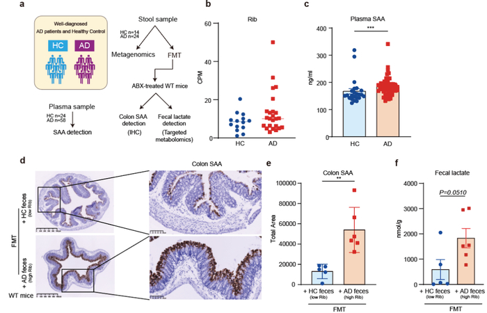 耿美玉团队最新研究，深入解析GV-971靶向菌群的作用机制|菌株_新浪新闻