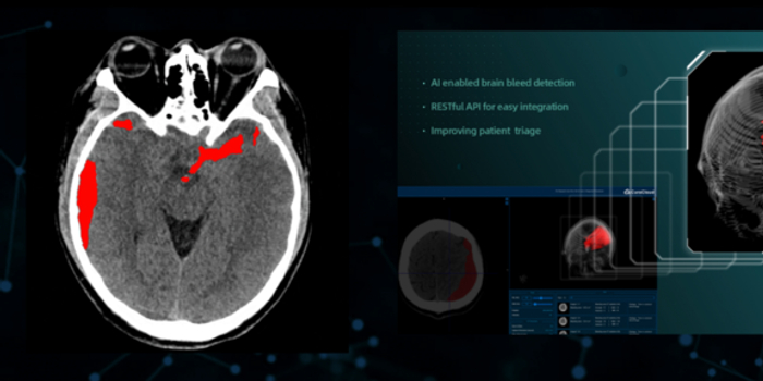 斩获三元，科亚医疗脑卒中AI产品获FDA认证_手机新浪网