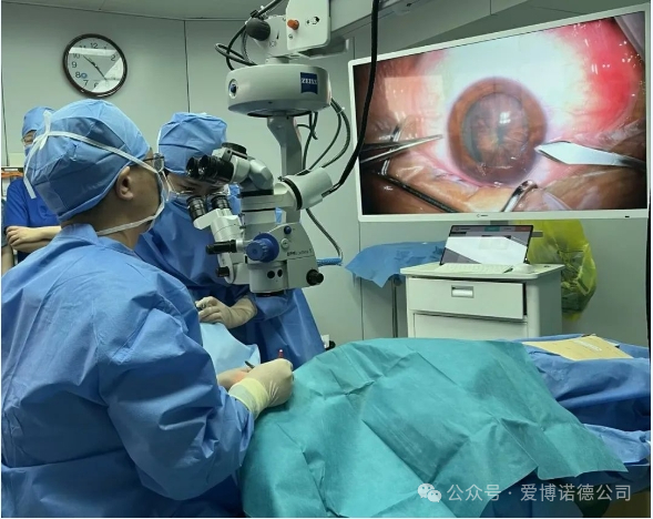 爱诺微实时4K3D显微手术成像系统：开启眼科手术新 “镜” 界！|3D|手术|爱诺_新浪新闻
