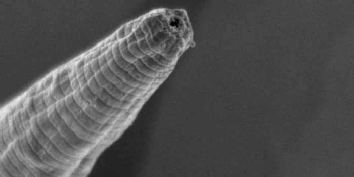 地球深处有动物存在吗？线虫耐高温高压_手机新浪网