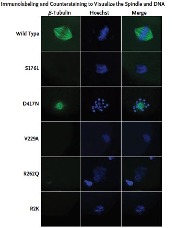 新基因 | TUBB8基因突变与女性卵母细胞减数分裂停滞|减数分裂|细胞|微管|突变|蛋白_新浪新闻
