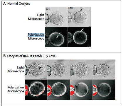 新基因 | TUBB8基因突变与女性卵母细胞减数分裂停滞|减数分裂|细胞|微管|突变|蛋白_新浪新闻